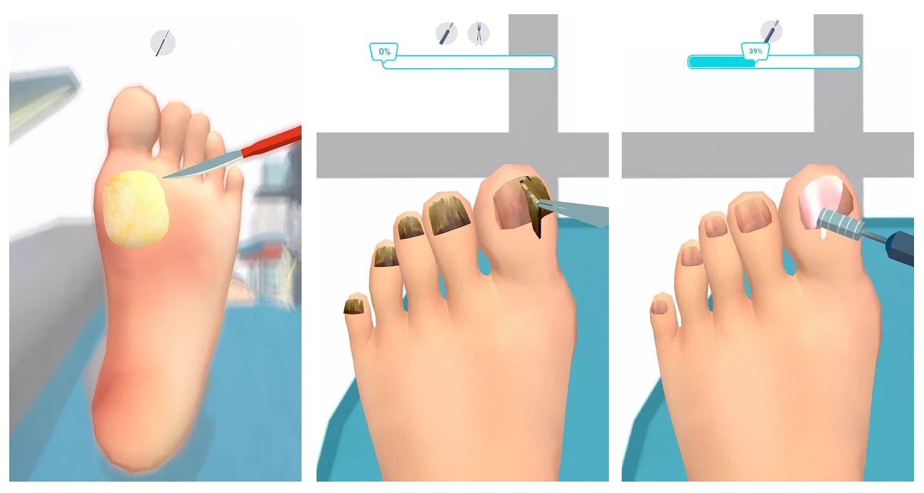 Foot Clinic- ASMR Feet Care, el juego del podólogo que triunfa en ...