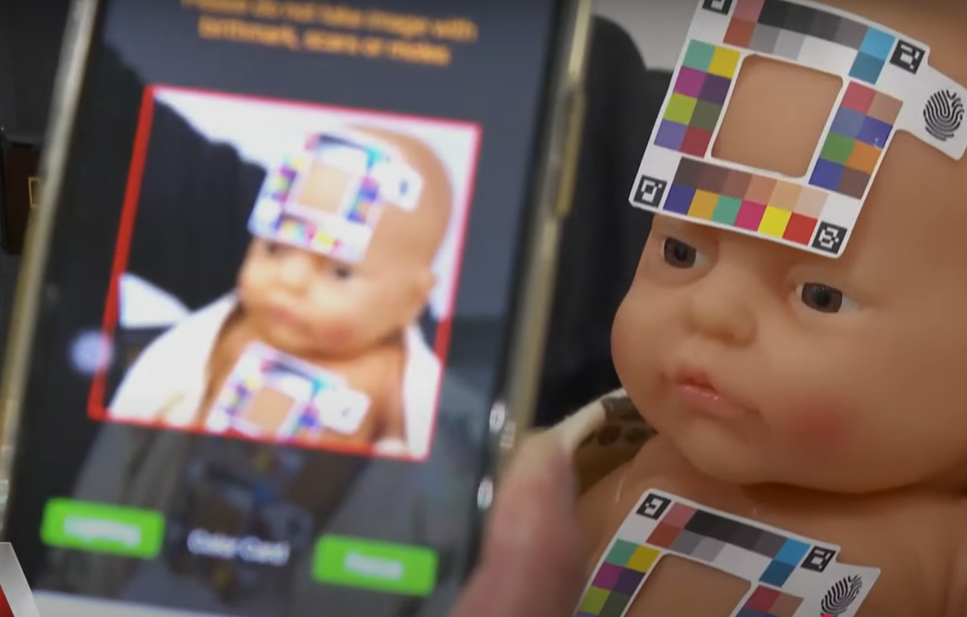 Una app permite identificar ictericia en recién nacidos : Applicantes ...