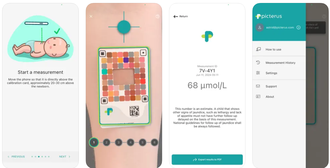 Una app permite identificar ictericia en recién nacidos : Applicantes ...